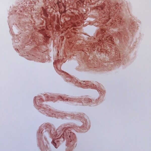 Premium Placenta Encapsulation Package + Postnatal Support - The ...